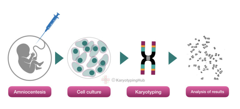 What is Karyotyping?- Definition, Steps, Process, and Advantages ...