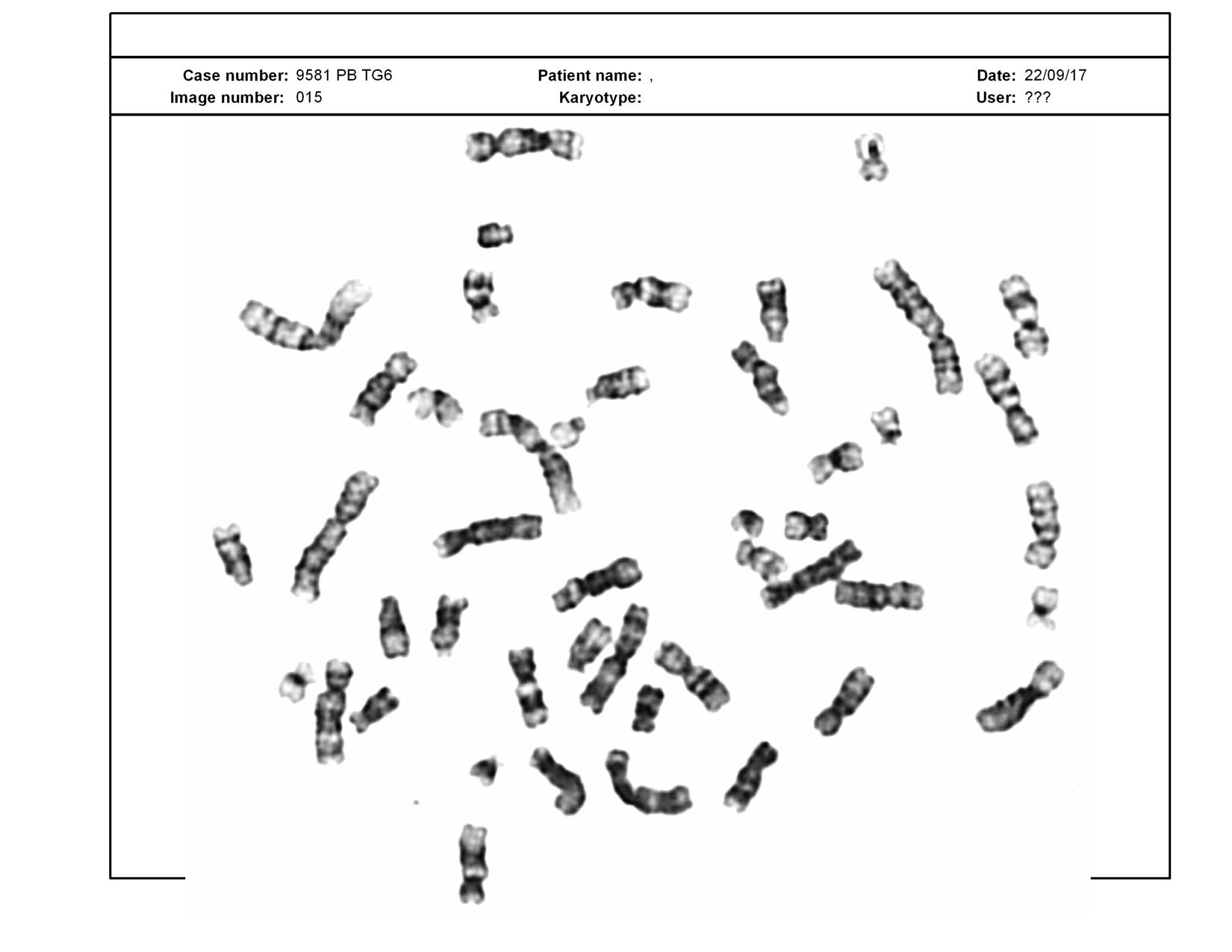 How to Present Karyotype in a Standard Form? – KaryotypingHub