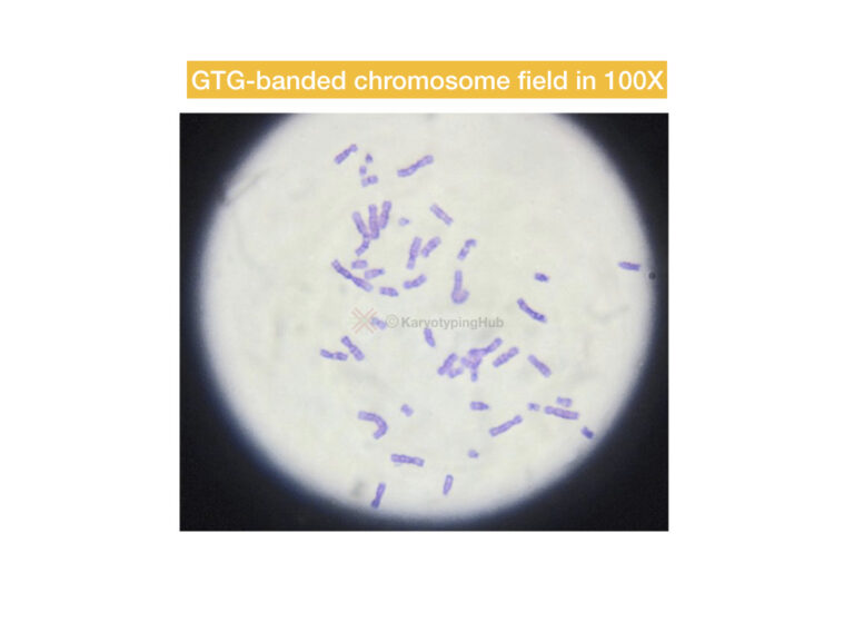 What is Karyotyping?- Definition, Steps, Process, and Advantages ...