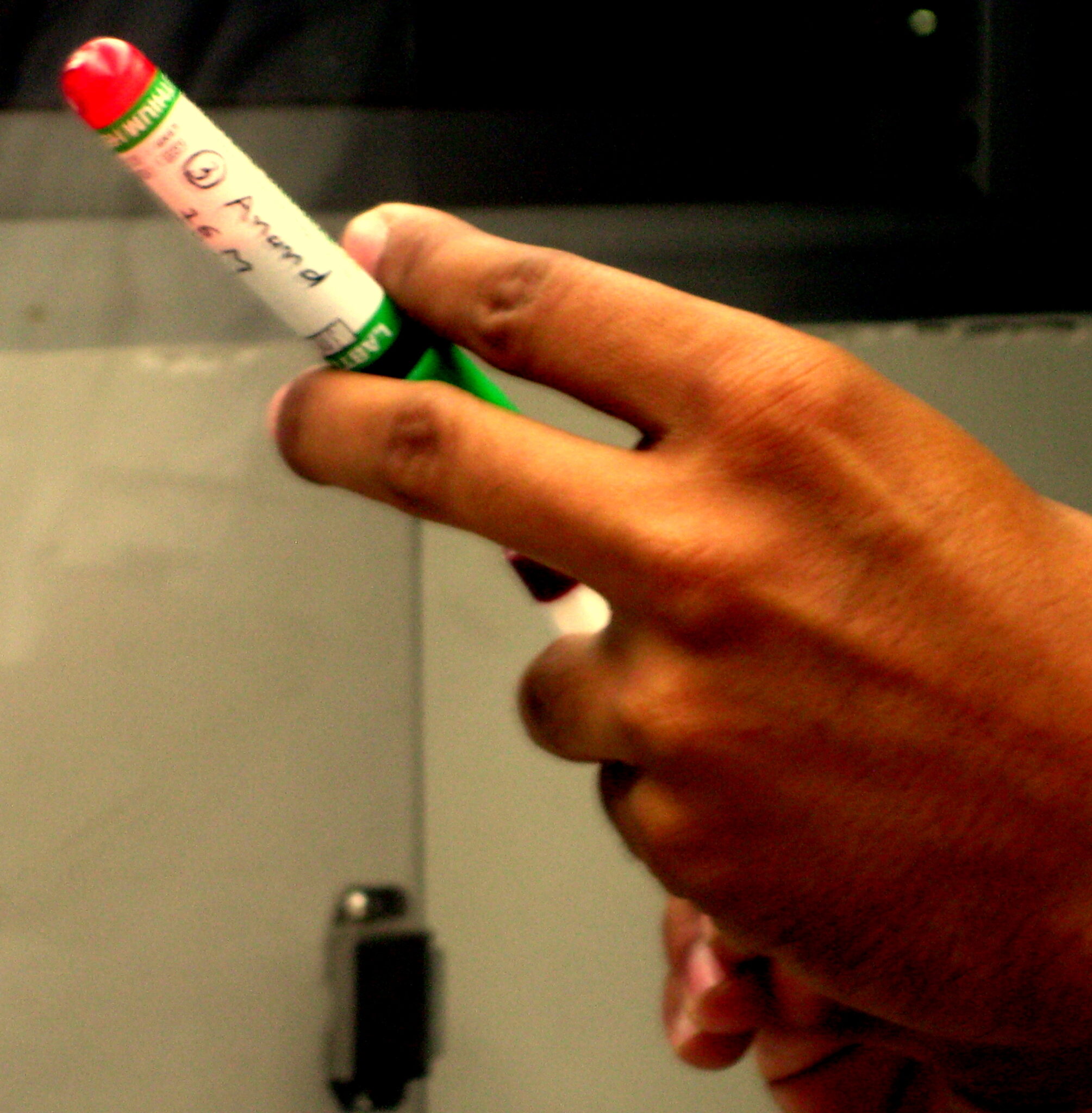 A karyotyping Test: What is It and How to perform it? – KaryotypingHub