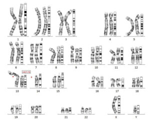 What does an Abnormal Karyotype Show? – KaryotypingHub