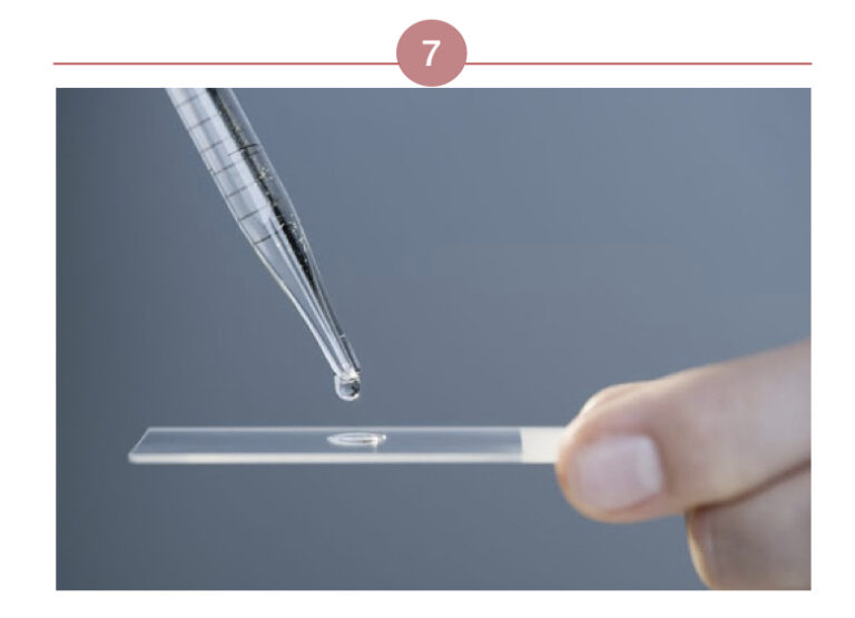 karyotyping- Step and procedure – KaryotypingHub