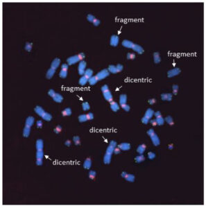 What is a Dicentric Chromosome?- Definition, Cause, Consequences ...